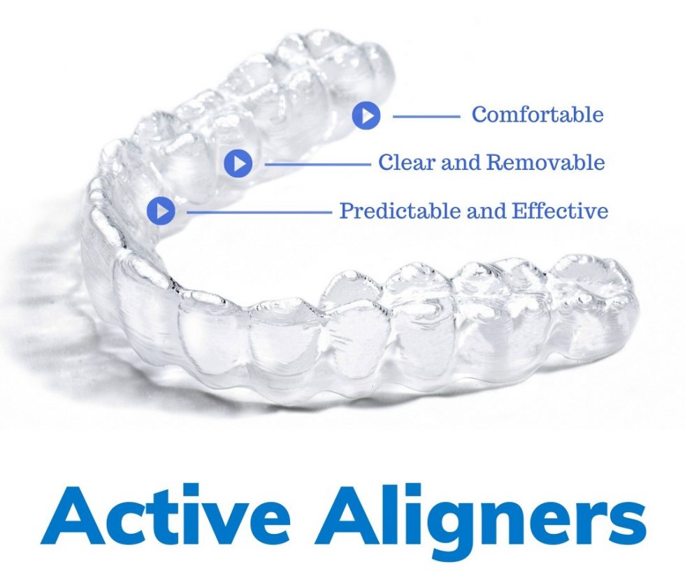 Active Aligners™ - Dr Nadya Abedian